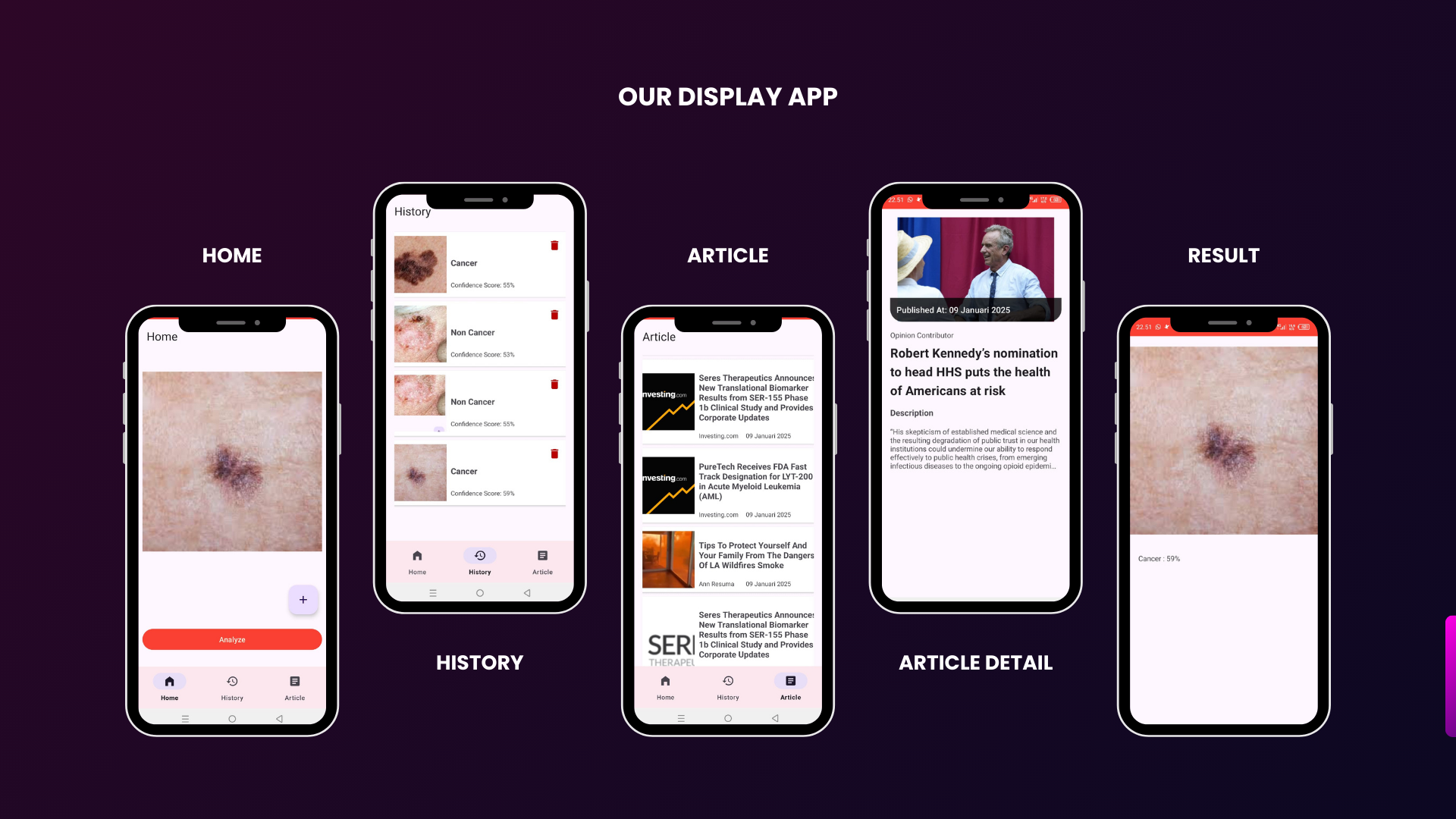 Portfolio Details - DevFolio Bootstrap Template